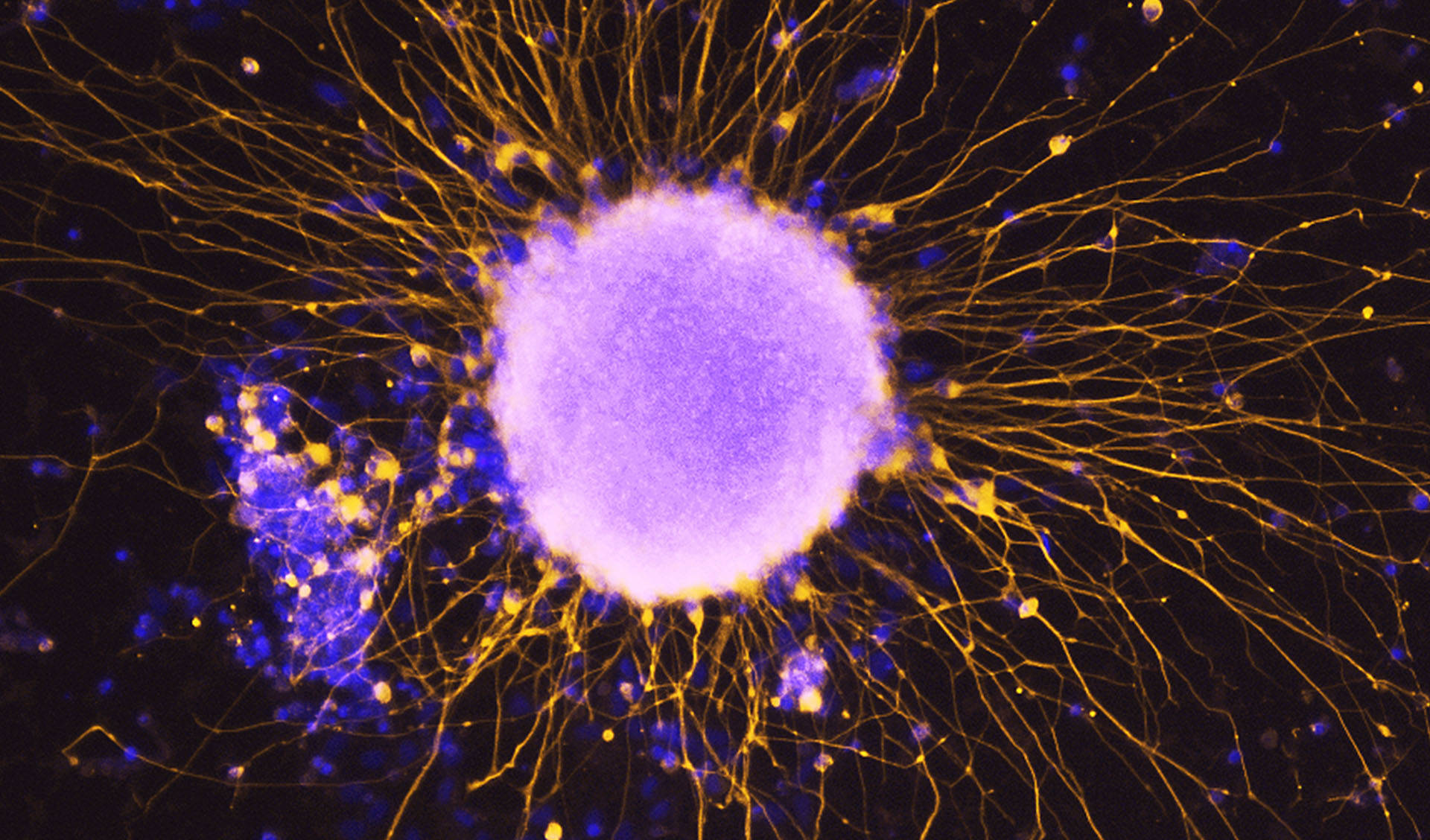 A Pathway to Hope | Neurological Foundation