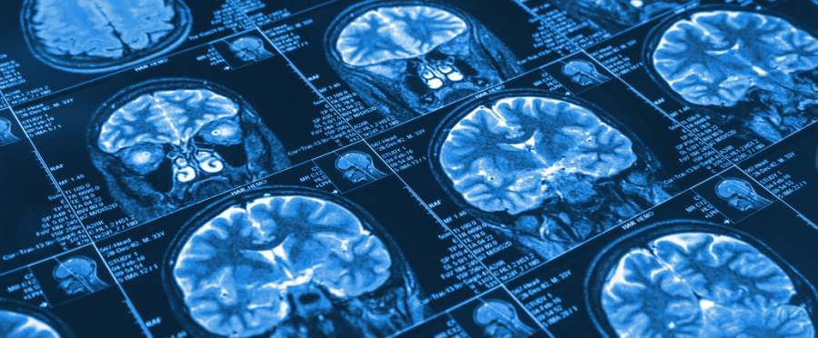 Strategy and Annual Report | Neurological Foundation